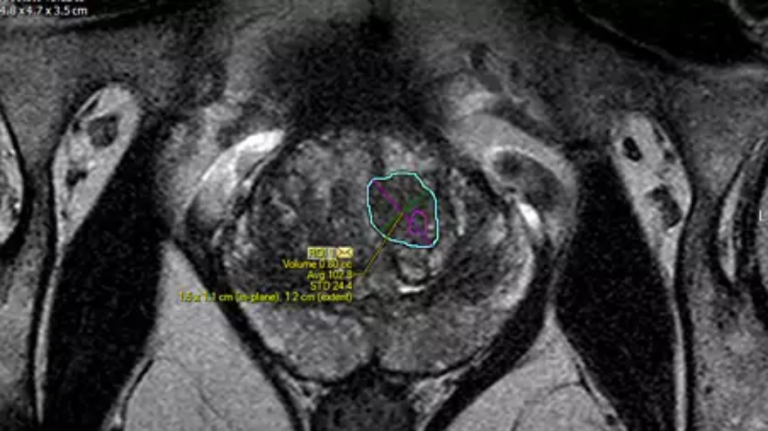 DynaCAD Prostate – Imaging Solutions