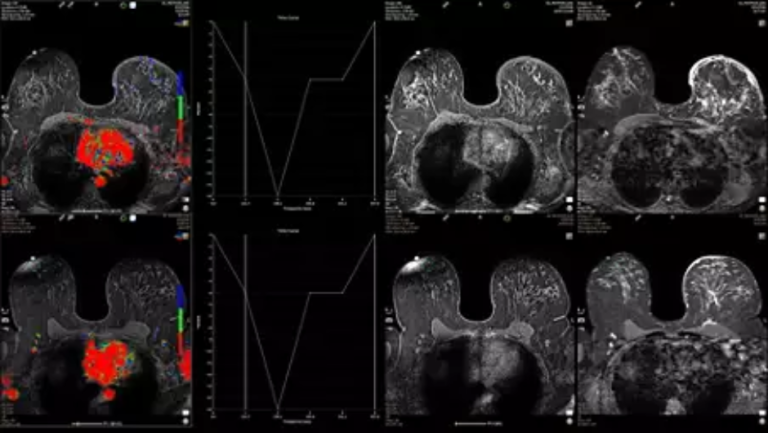 DynaCAD Breast – Imaging Solutions