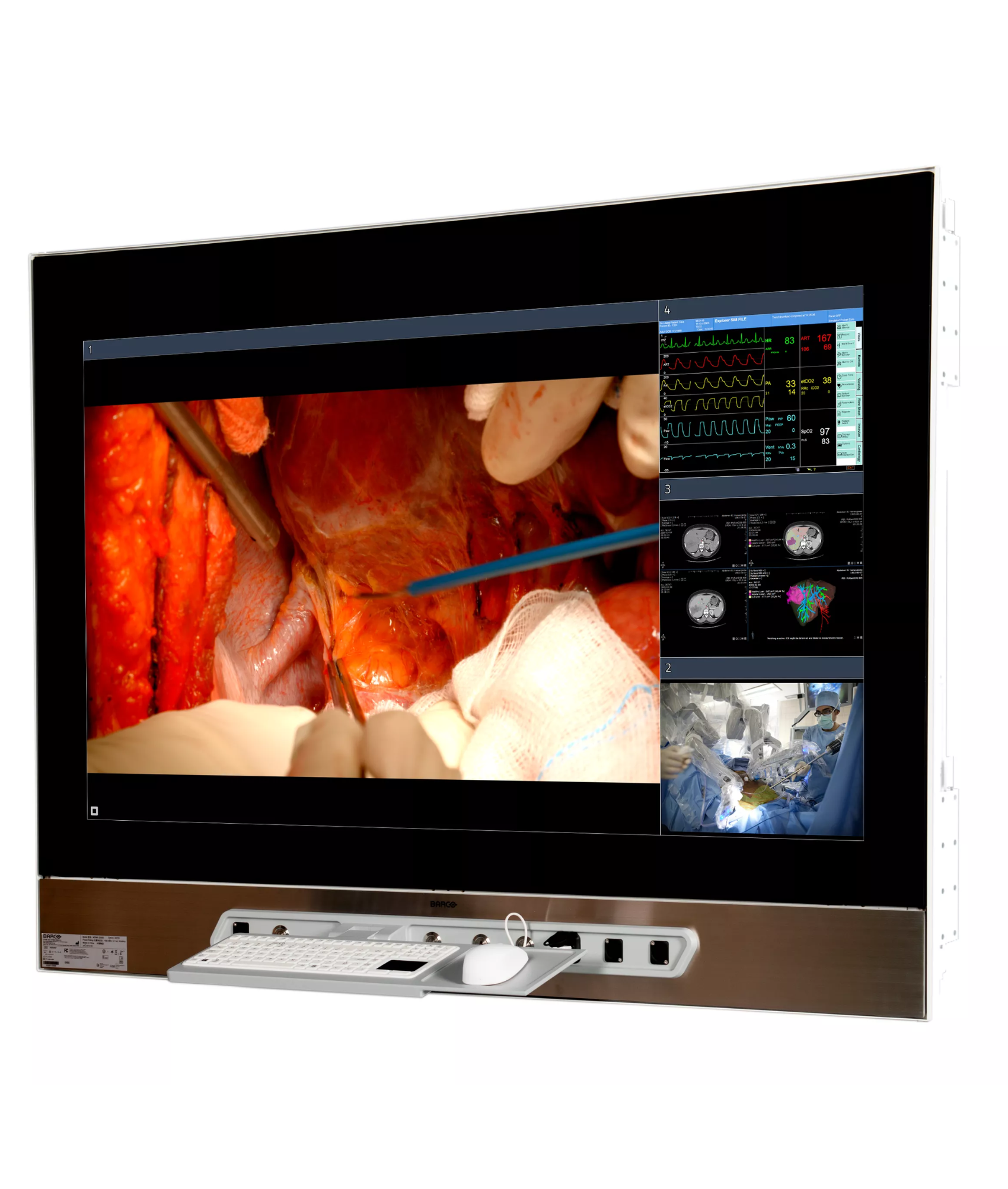 Surgical Displays – Imaging Solutions